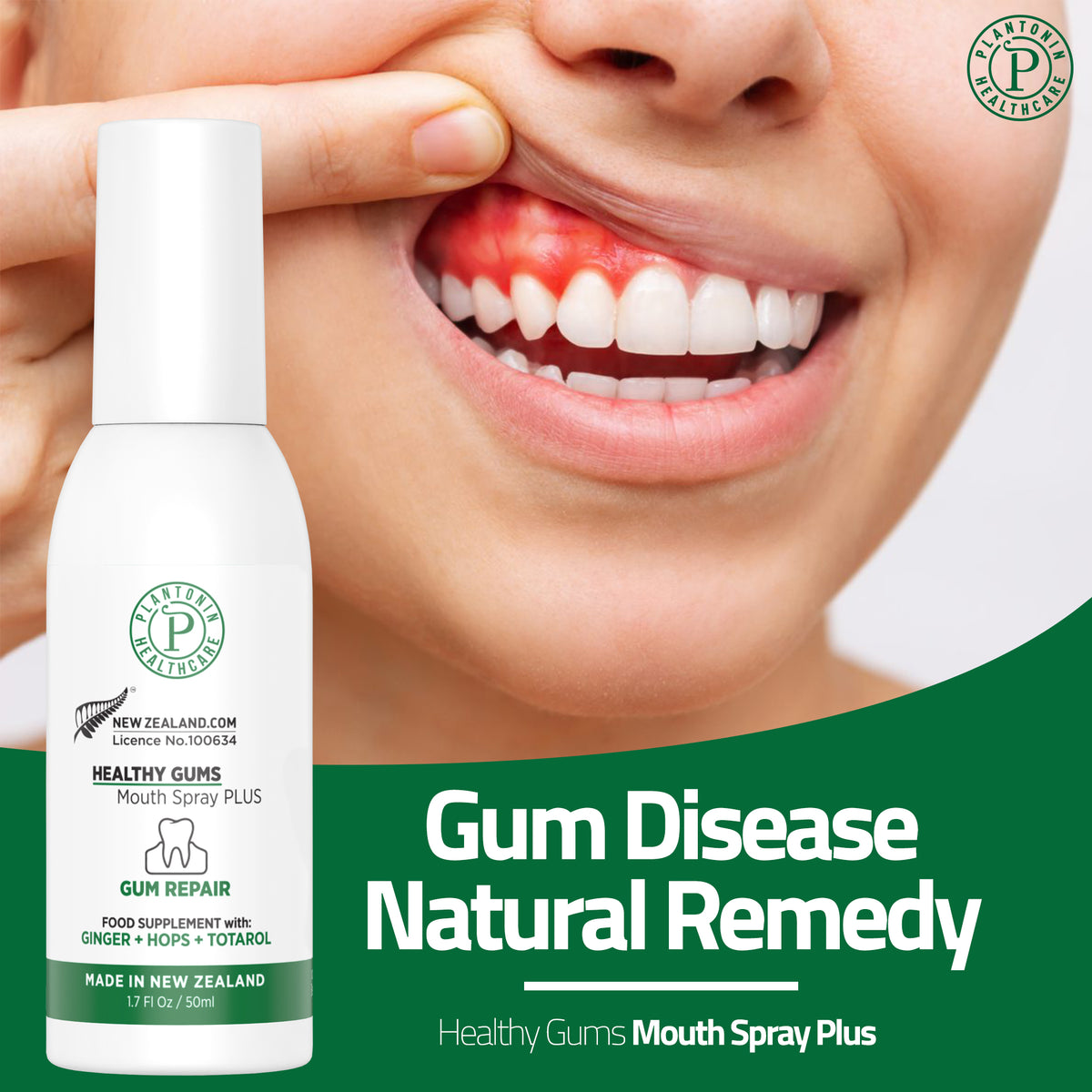 Healthy Gums Mouth Spray – Plantonin